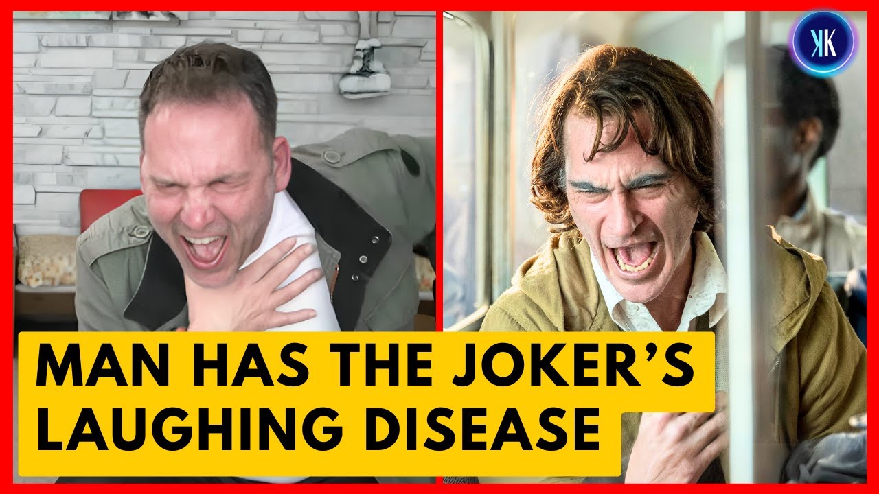This Man Has The Same Laughing Disease As The Joker - YouTube