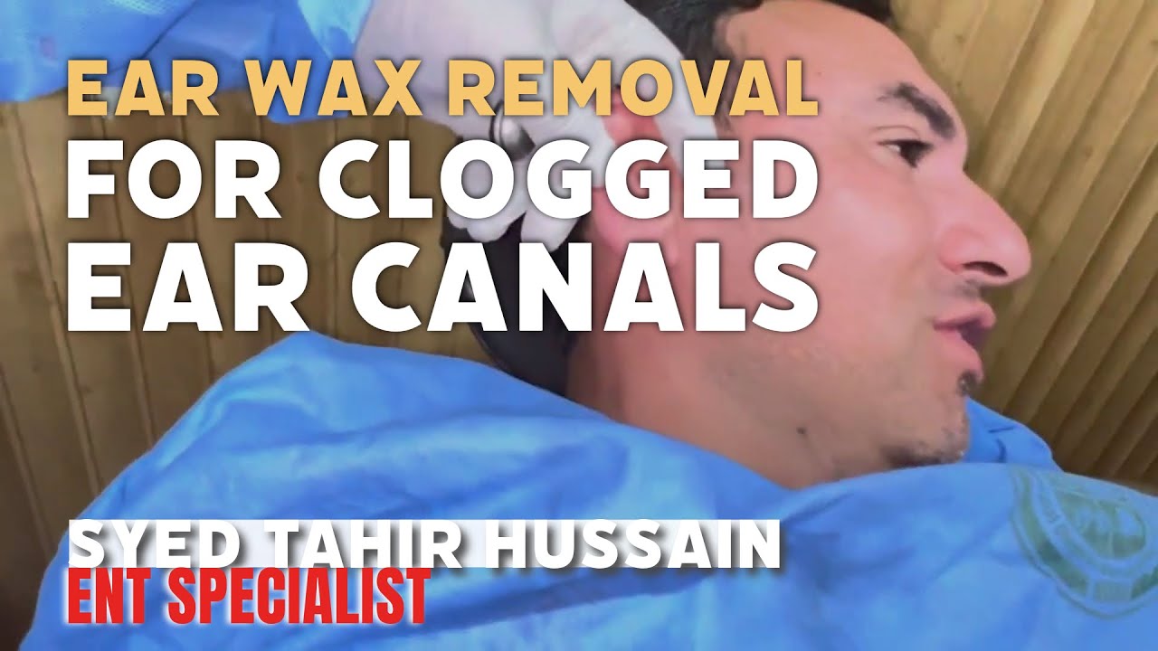 Hearing Restored: Effective Ear Wax Removal for Clogged Ear Canals ...