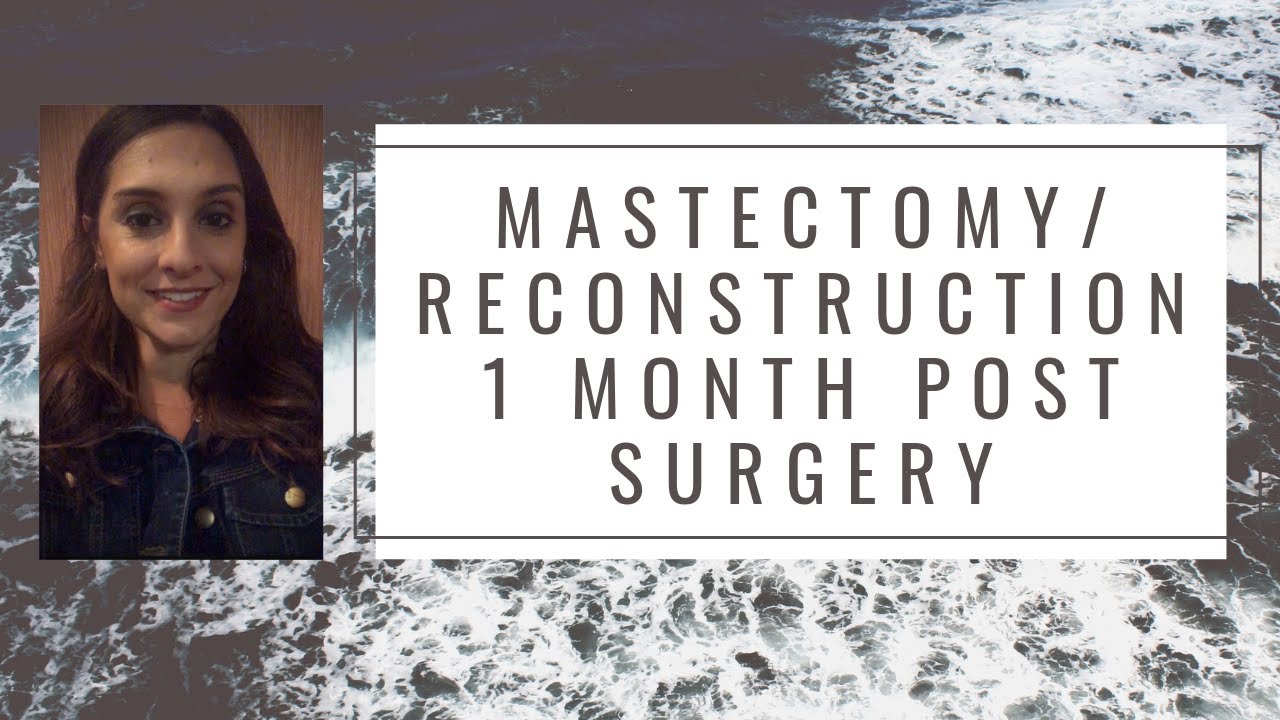 Double Mastectomy / Reconstruction | One Month After Surgery Mastectomy ...