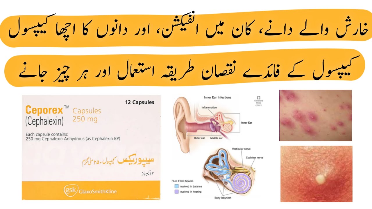 ceporex | dano ka acha capsule | Cephalexin | uses | side effect ...
