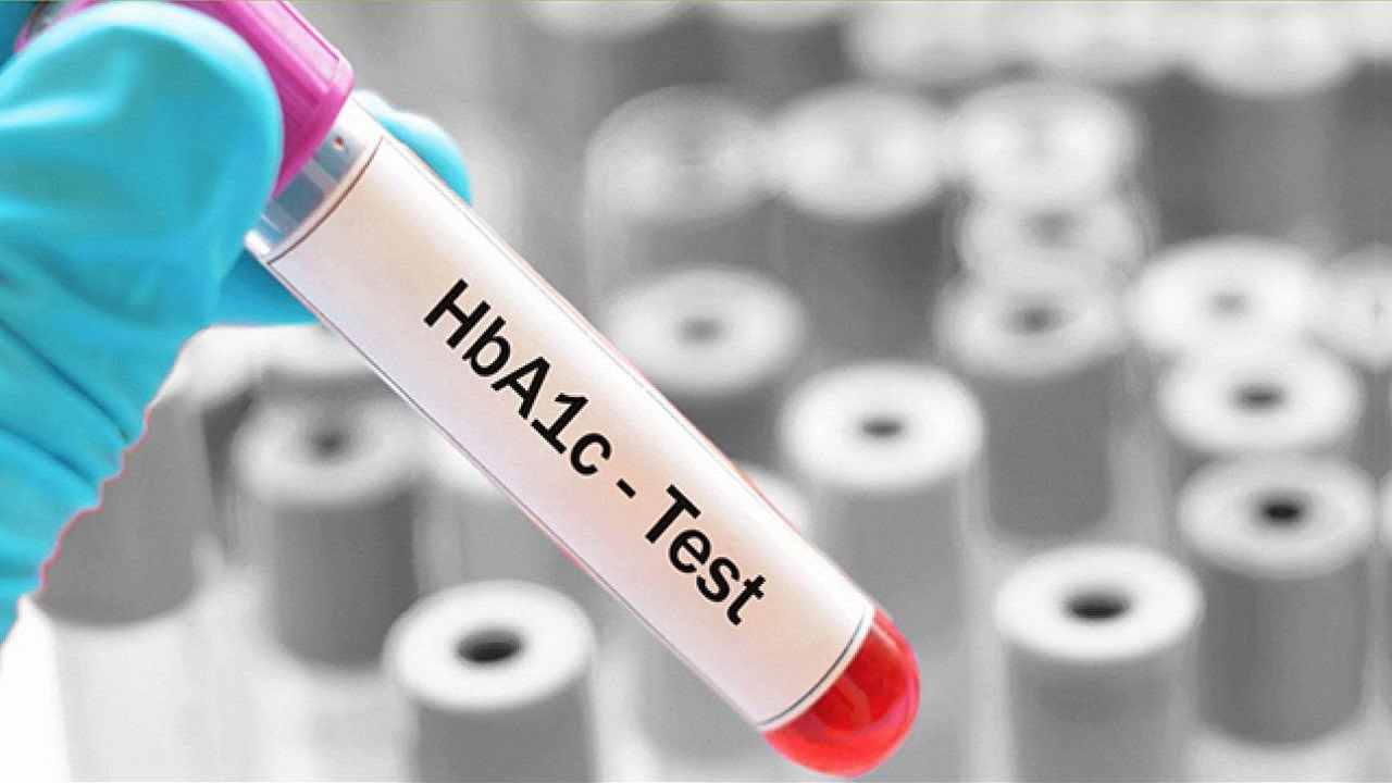 Hba1C Nedir? Hba1C Ne Demek? , HbA1c YÜKSEKLİĞİ – GRWZC