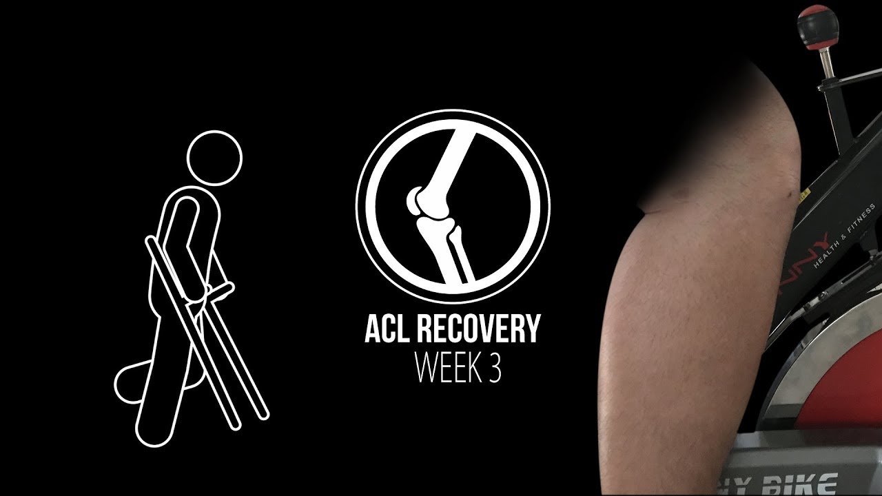 ACL Surgery Week 3 | ACL Reconstruction with Hamstring Auto graft ...