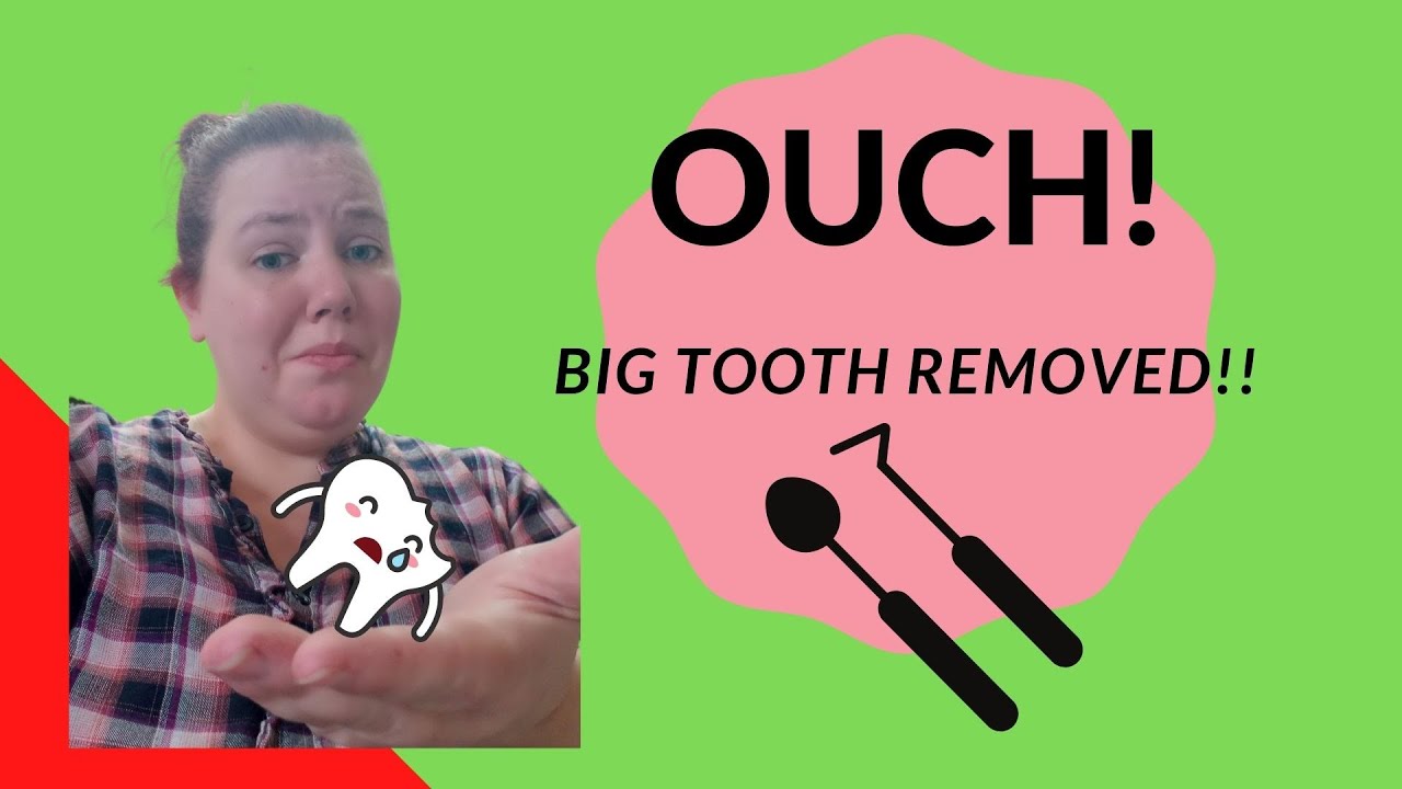 Ouch! Tooth Pulled! - YouTube