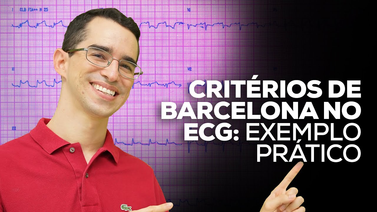 Critérios de Barcelona no ECG: exemplo prático - YouTube