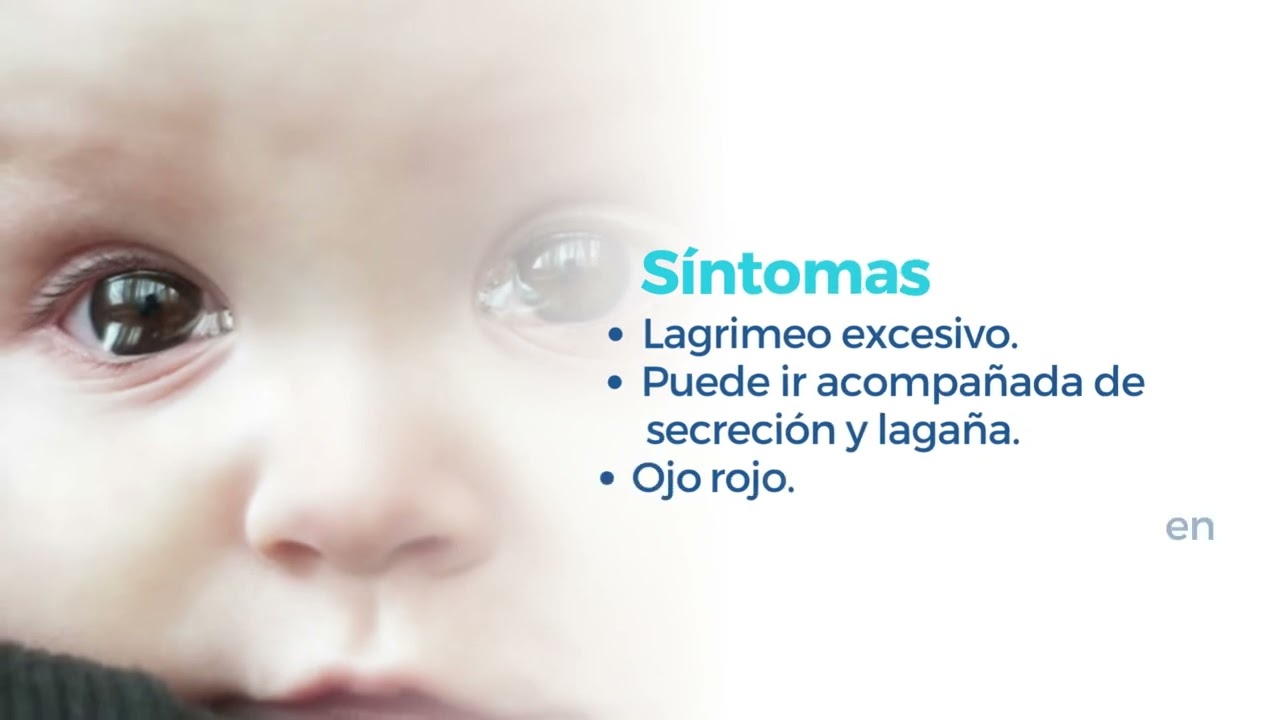 Conducto Lagrimal Obstruido En Un Niño Pequeño