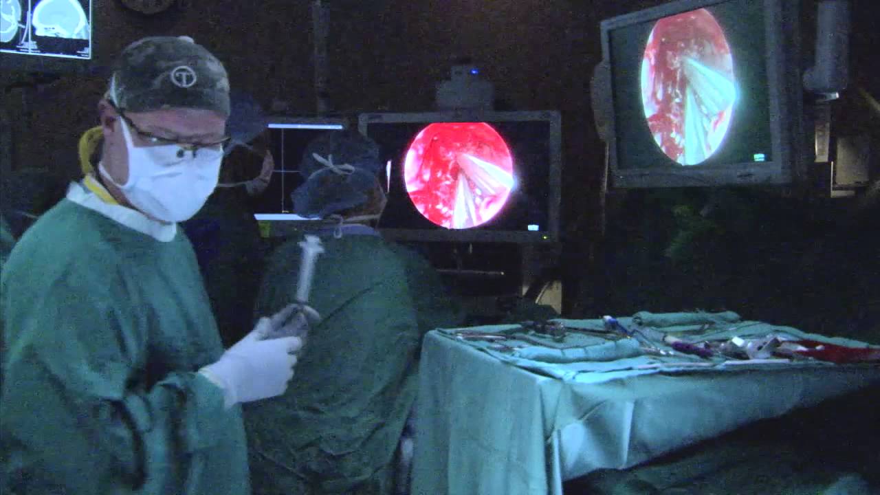 U of L Hospital surgeon Performs Extended Endoscopic Skull-based ...