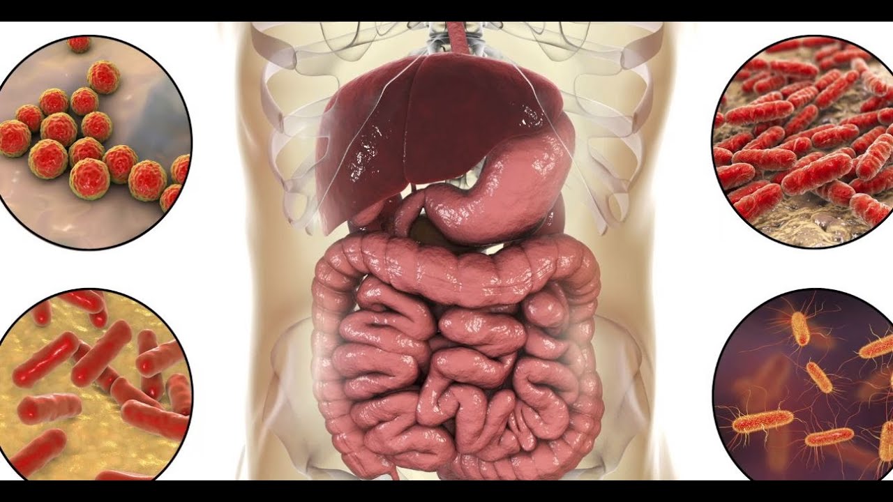 Alternative stable states in the intestinal ecosystem - YouTube