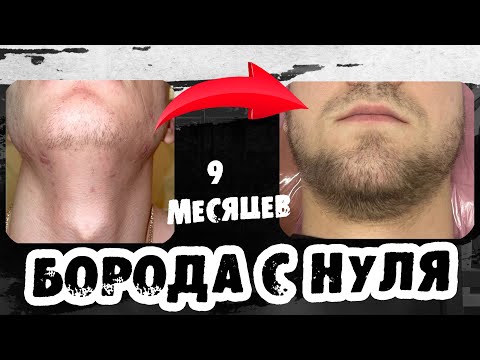 Капиксил М для роста бороды 2-ой курс  / Выпуск 47 / Андрей Борода