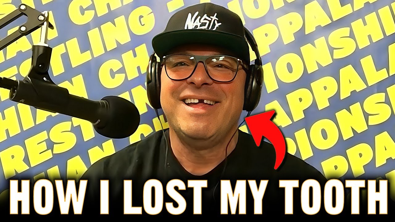 Jerry Sags Reveals How He Lost His Tooth - YouTube