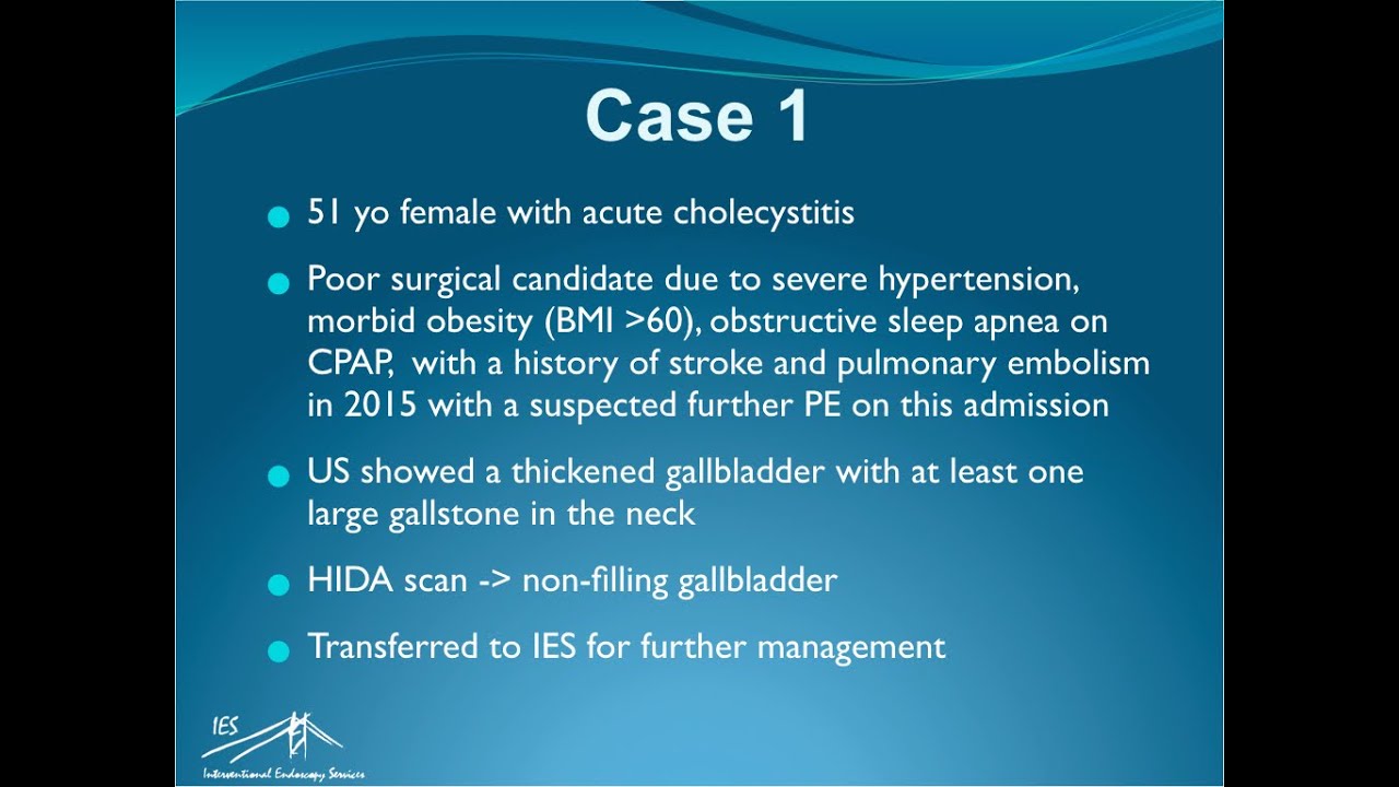 IMAGE 2016 LIVE: Case 1 (EUS-guided GB drainage with Hot AXIOS) - YouTube