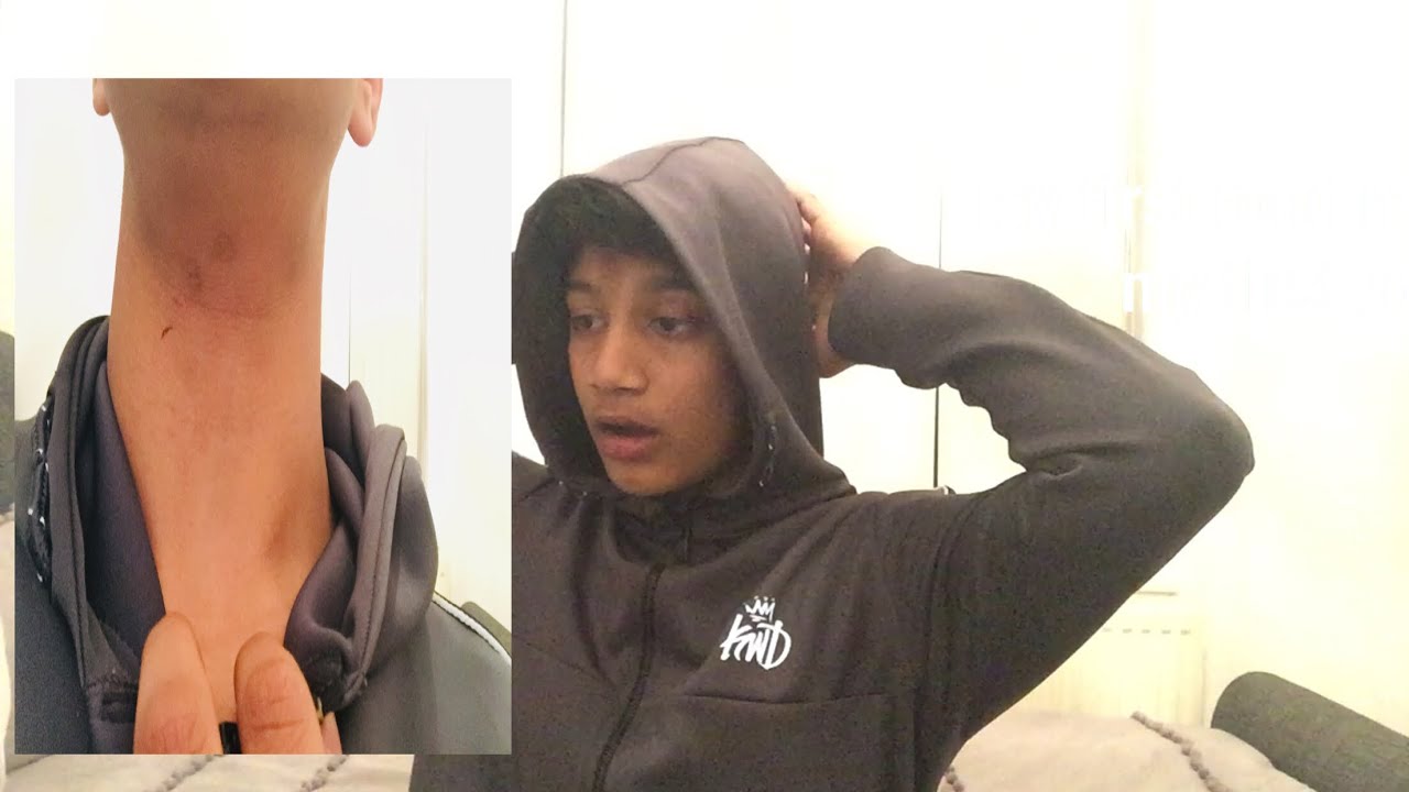 My First Ever Fight With A Roadman 🤬😱(storytime) - YouTube