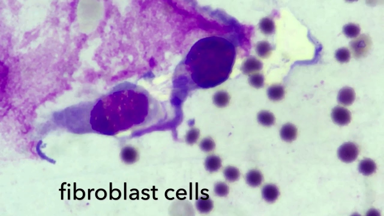 Fibroblast cells morphology - YouTube