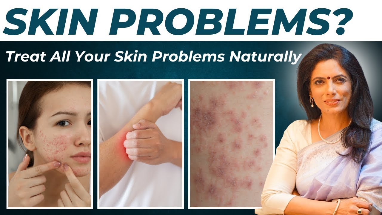 Get Rid of All Skin Problems Naturally || Ayurvedic Expert Dr Smita ...