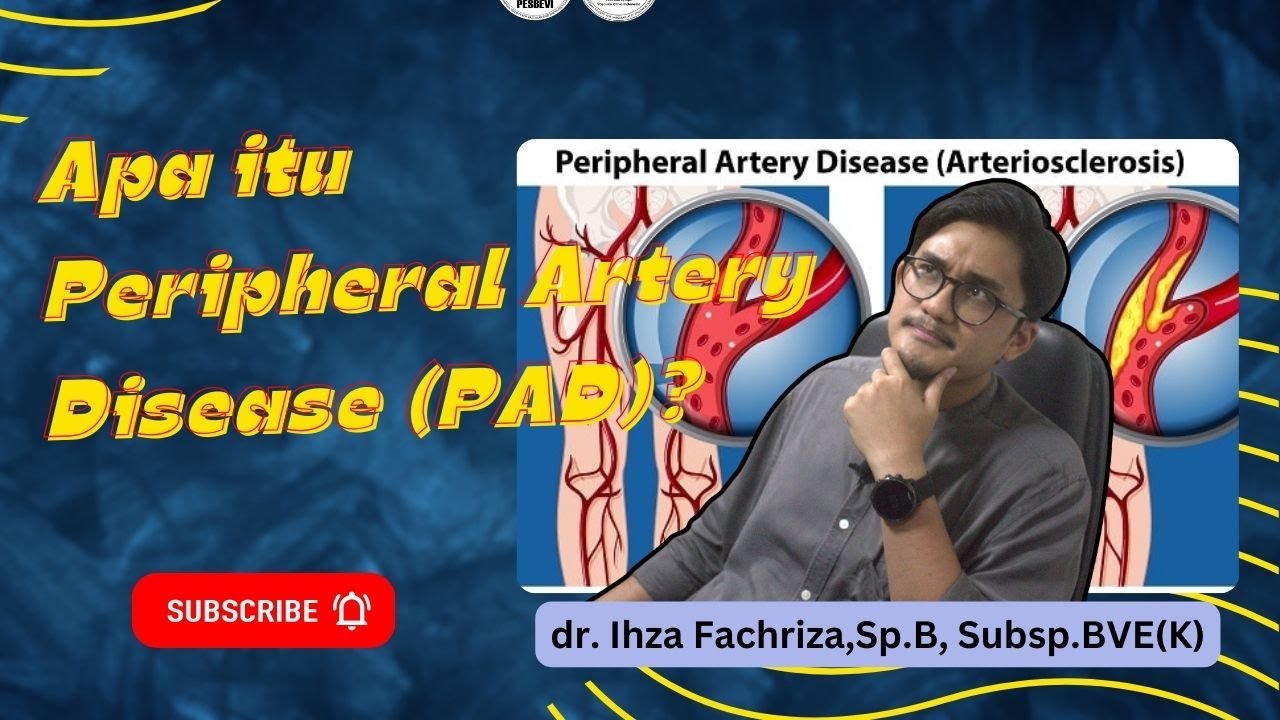 Apa itu Peripheral Artery Disease (PAD)? - YouTube