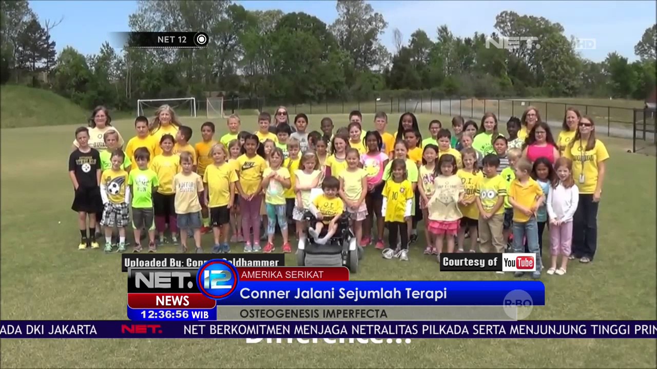 Conner Goldhammer, Penderita Osteogenesis yang Menginspirasi Dunia ...