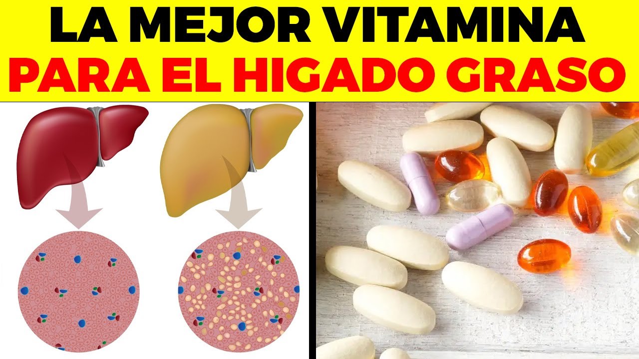 ¡TU HÍGADO GRASO te AGRADECERÁ que CONSUMAS ESTA VITAMINA! - YouTube