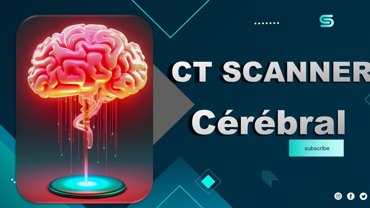 Démonstration CT Scanner cérébral _partage de pratique _ - YouTube