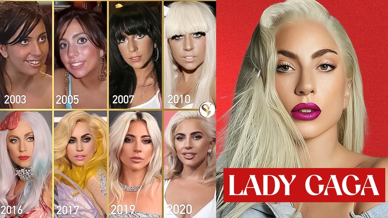 Lady Gaga’s Plastic Surgery Secrets: From Fillers to Facial Evolution ...
