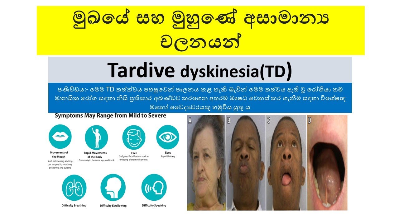 Tardive dyskinesia (Abnormal oral and facial movements) | මුඛයේ සහ ...