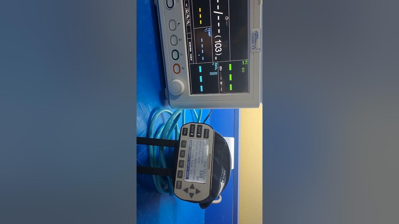 NIBP FAILURE - YouTube