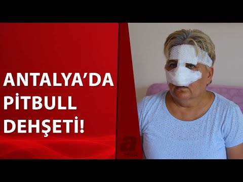 Çocuk parkında korkunç olay! 2 pitbull, saldırdığı kadının burnunu kopardı | A Haber