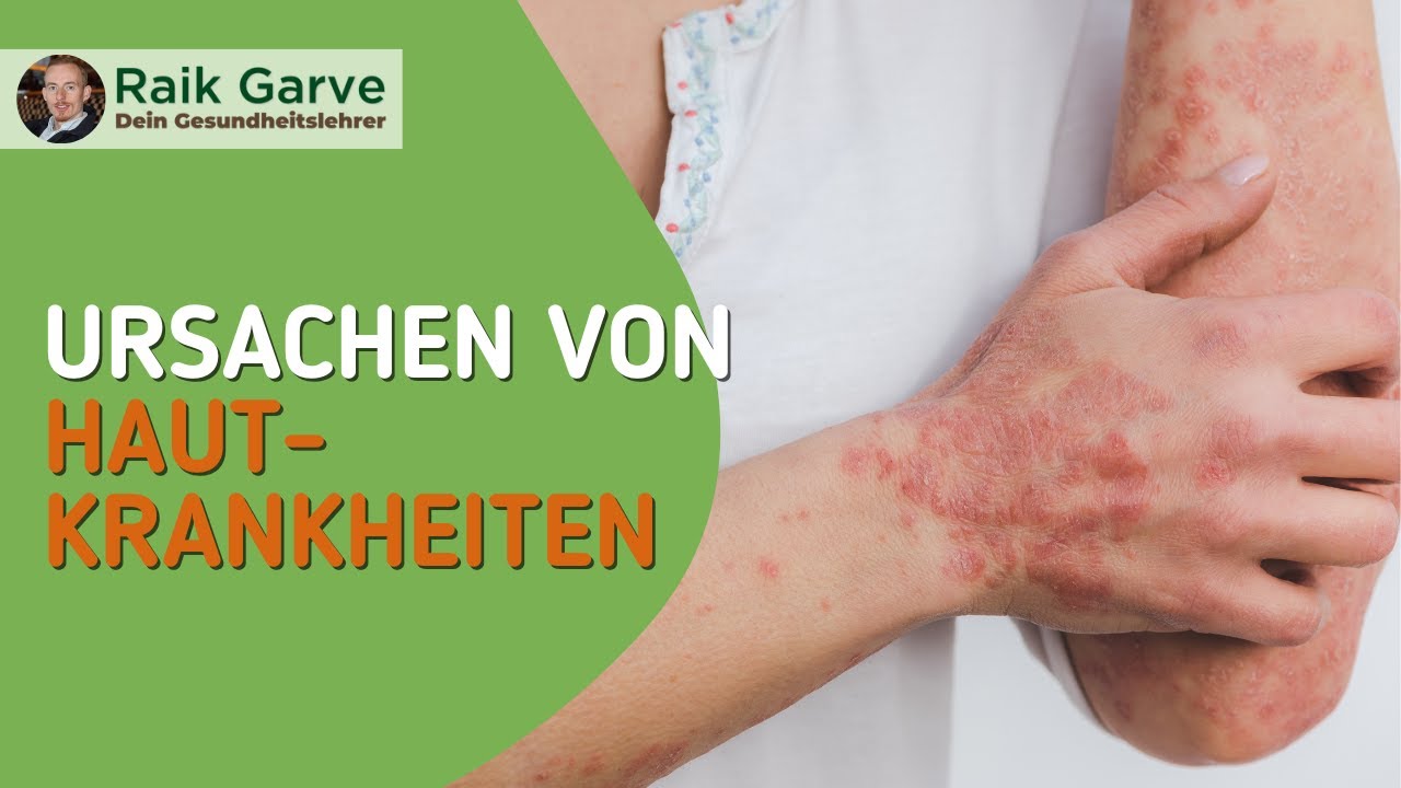 Die tieferliegenden Ursachen von Hautkrankheiten enthüllt - YouTube
