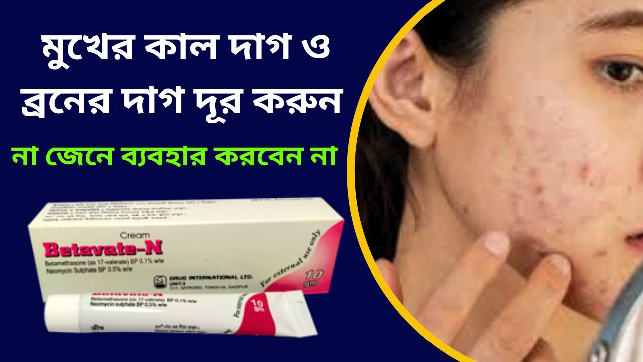 Betavate N Cream Review । কখন? কেন? কীভাবে ব্যবহার করবেন বিস্তারিত ...