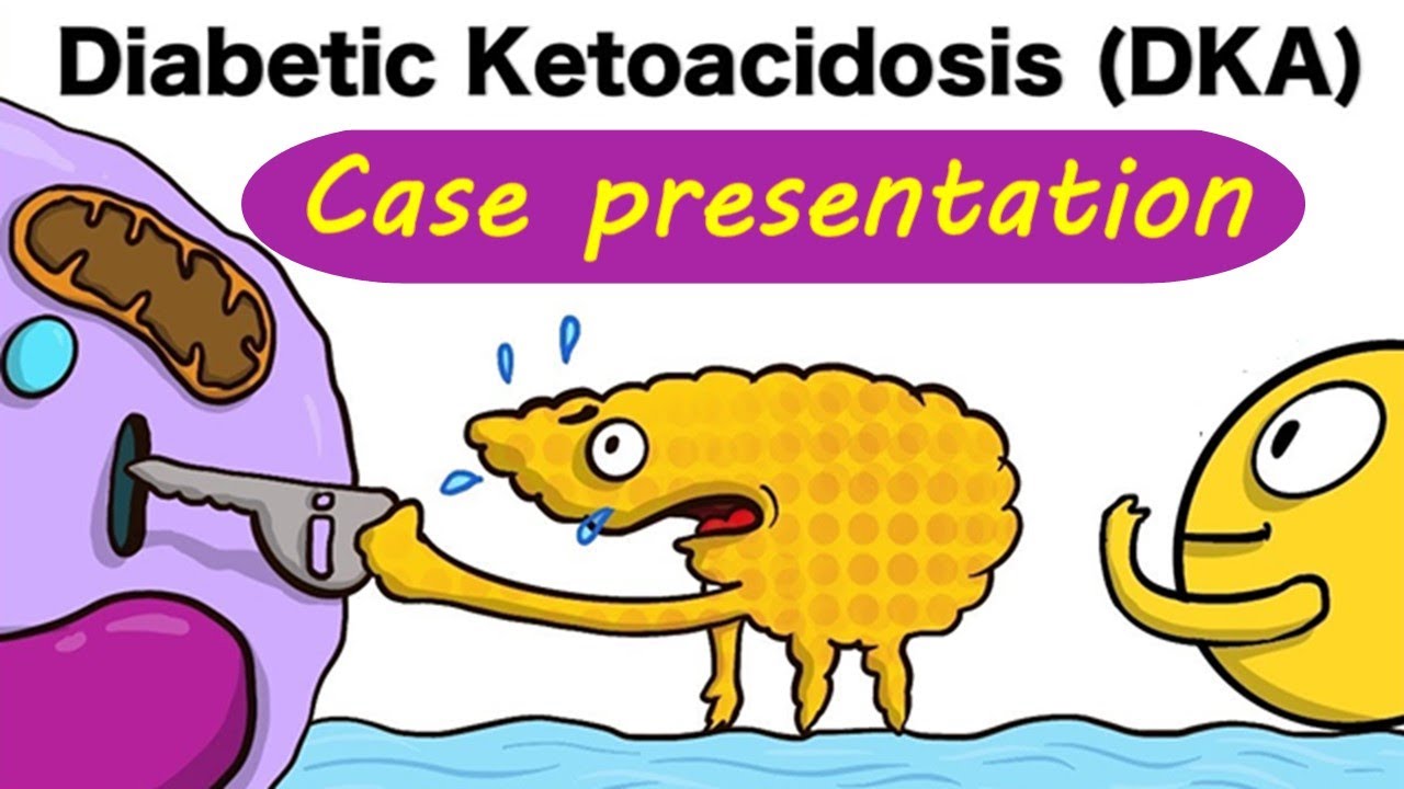 Diabetic Ketoacidosis case presentation - YouTube