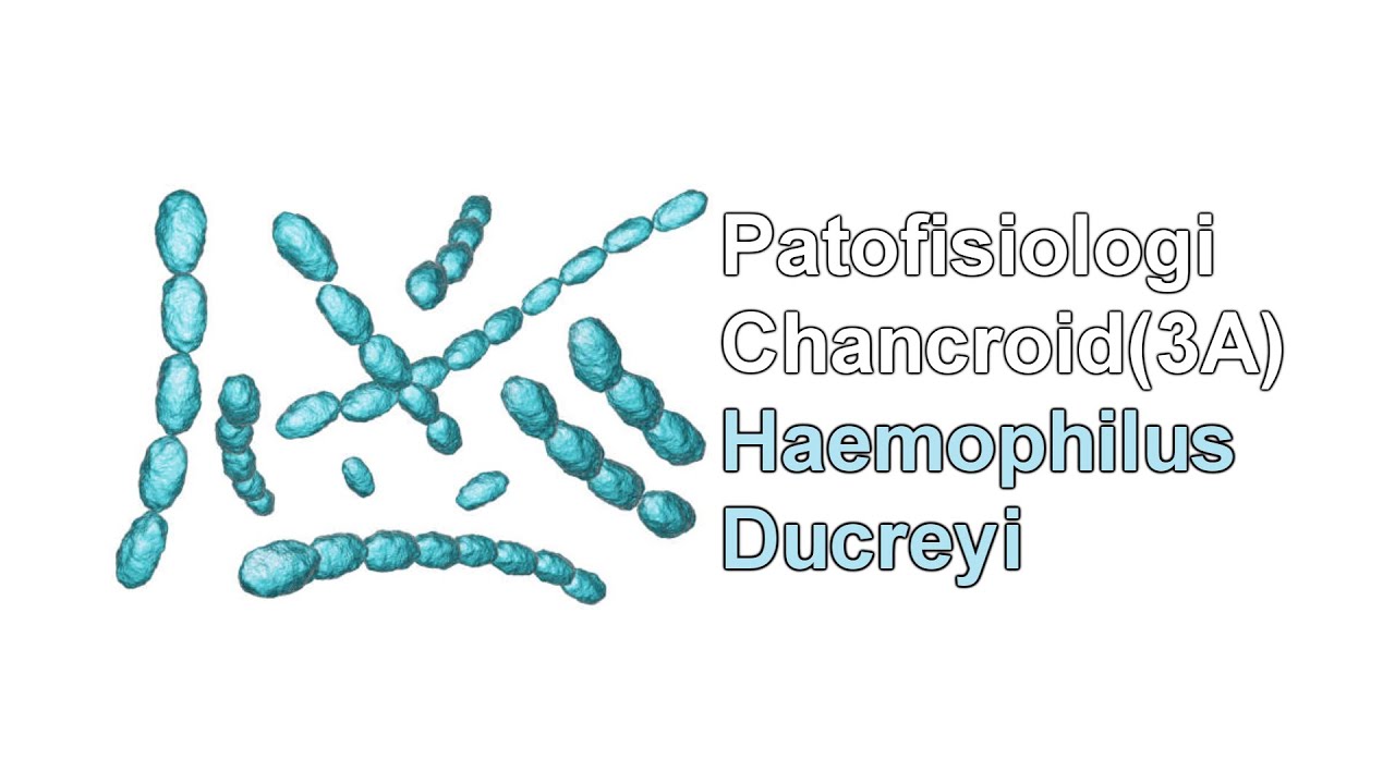 Patofisiologi Chancroid/Ulkus Mole - YouTube