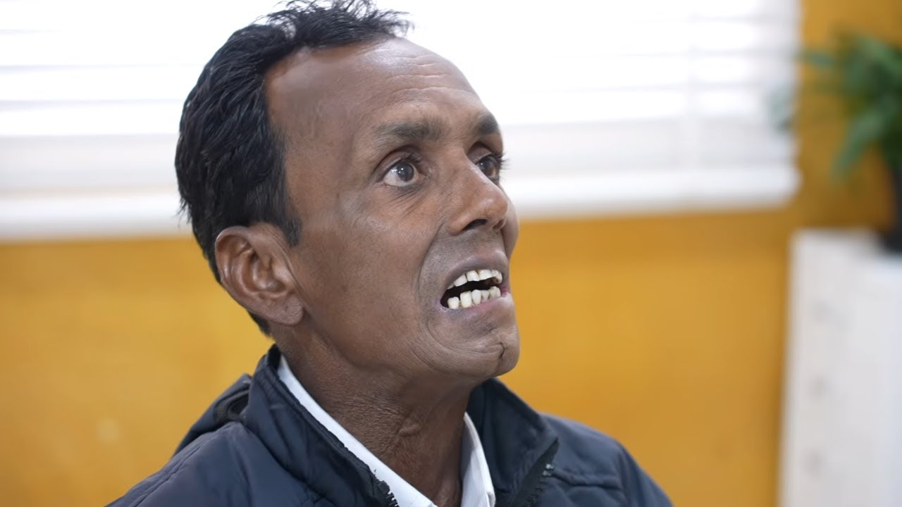 Less Mouth Opening After Oral Cancer Surgery - YouTube