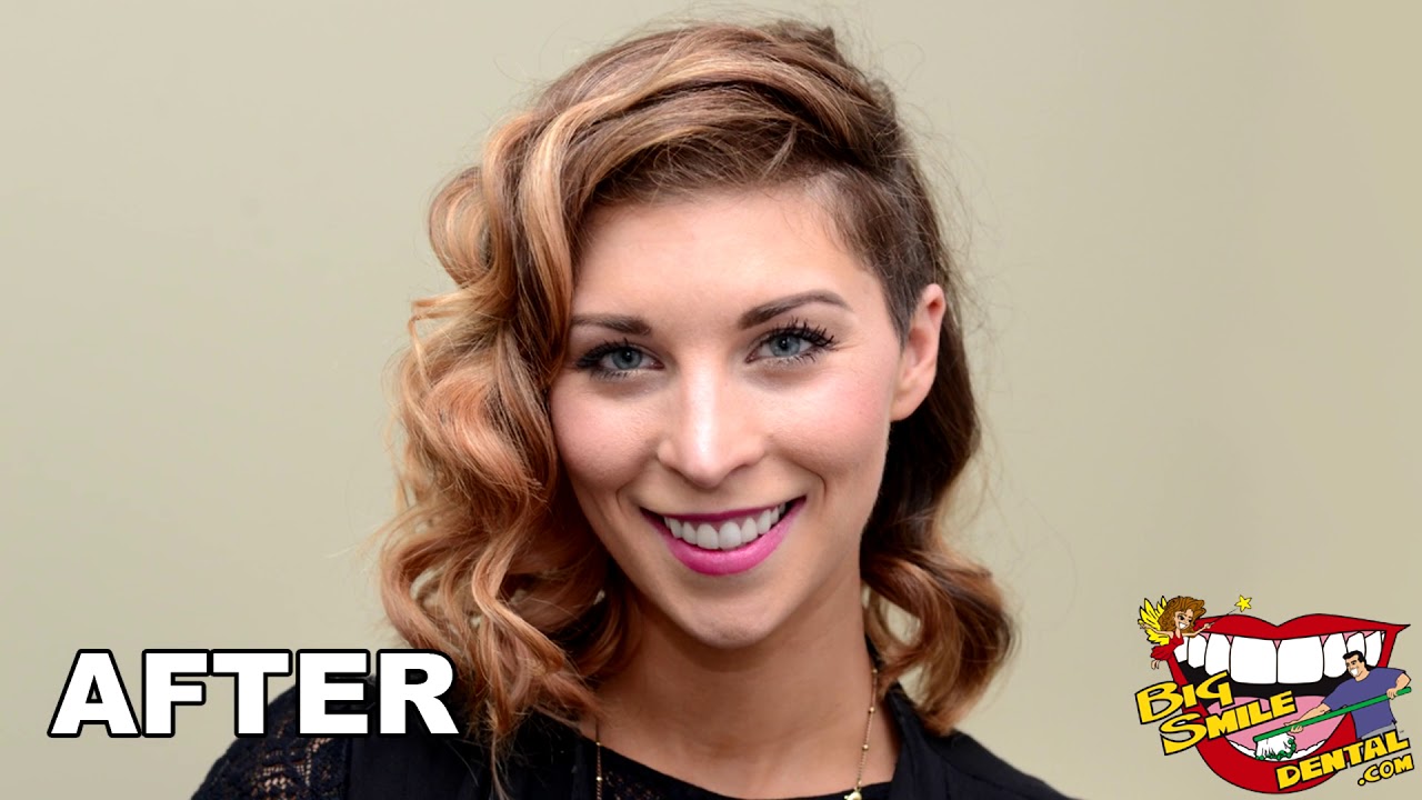 Pop Artist Mandy Barry Shares How Dr. Siegel Changed Her Smile with ...