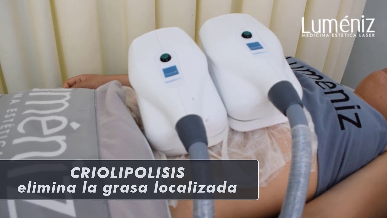 CRIOLIPOLISIS - YouTube