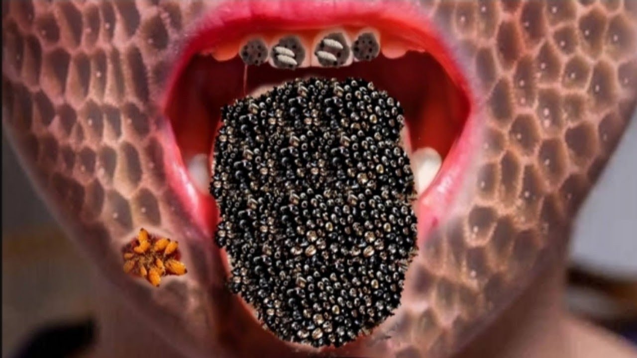 asmr treatment for infected wound and maggot removal from red boy lips ...