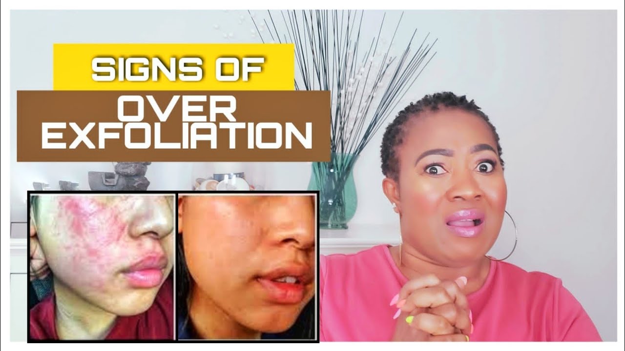 5 SIGNS THAT YOU MAY BE OVER -EXFOLIATING YOUR SKIN😳 - YouTube