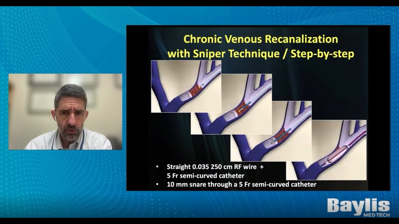 The Sniper Technique | Part 3: Recanalization of Challenging Central ...