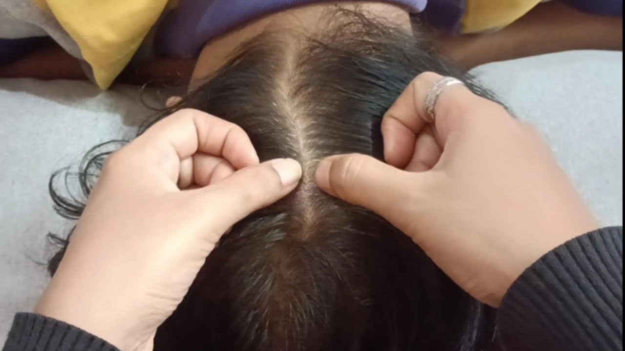 Scalp Check & Sleep: The Science of Hair Growth - YouTube