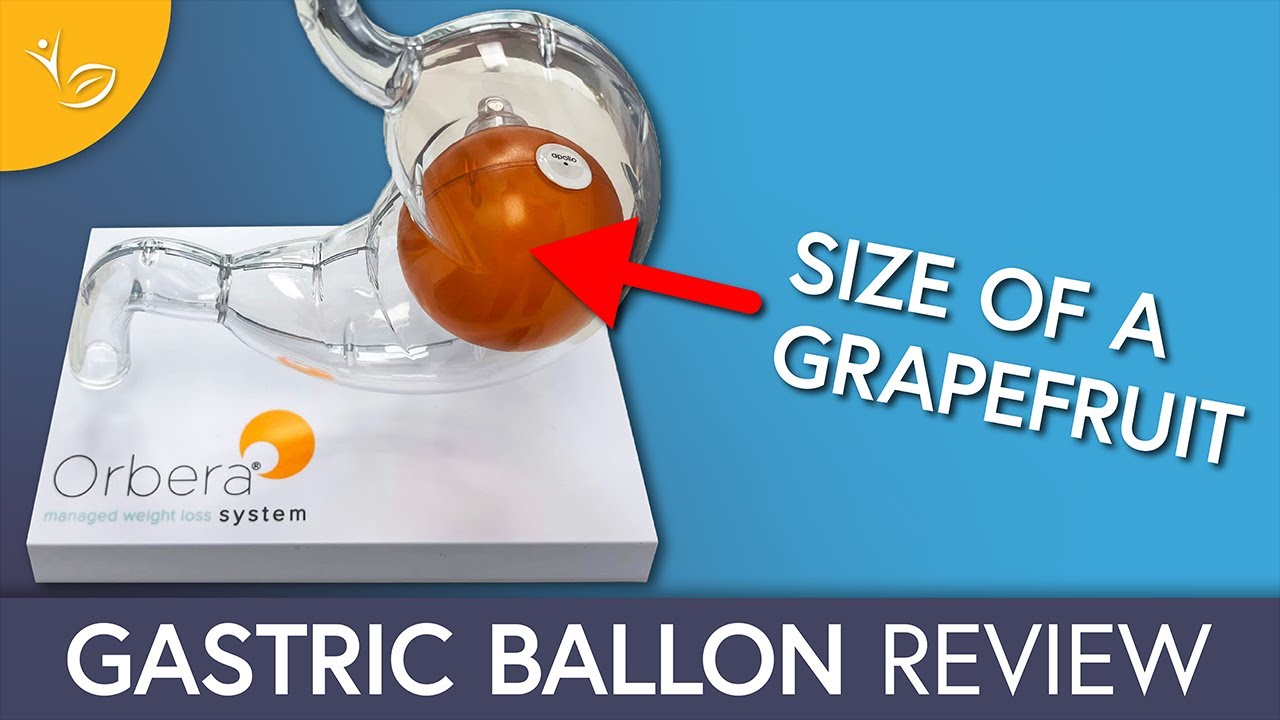 A Doctor's Quick Review of the Orbera Gastric Balloon - YouTube