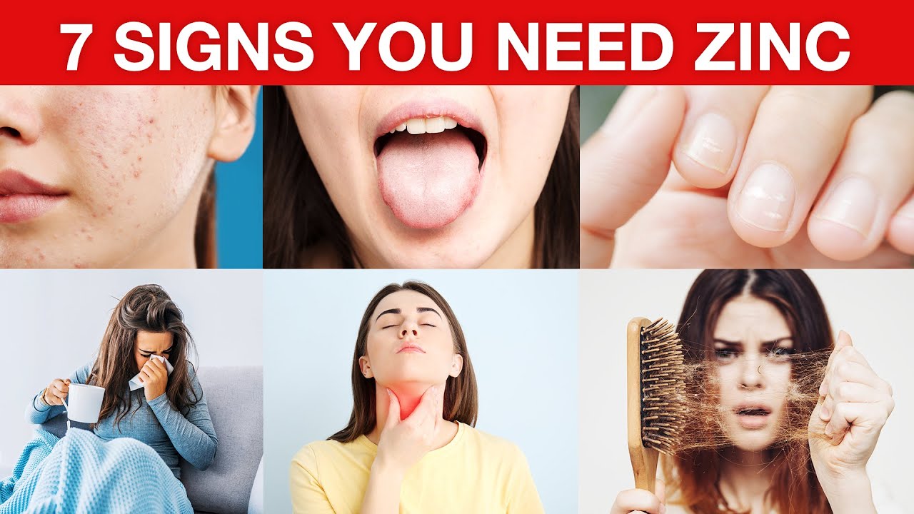 7 Early Warning Signs You May Be Low in Zinc | Dr. Janine - YouTube
