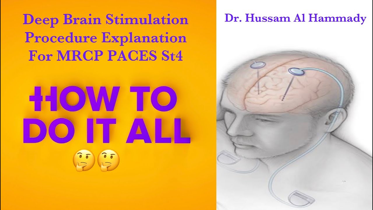 Procedure Explanation For MRCP PACES, Station 4 (Deep Brain Stimulation ...