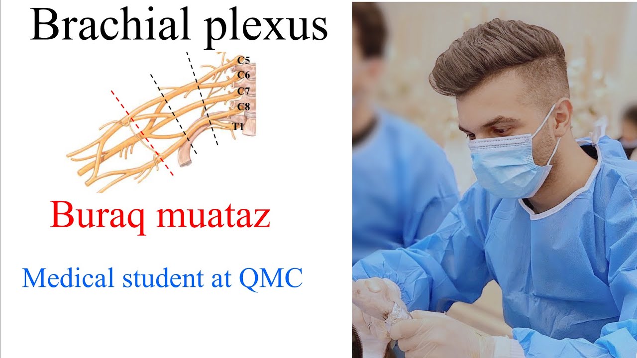 Brachial plexus, Root, Trunk, Division & cord ,,part1 - YouTube