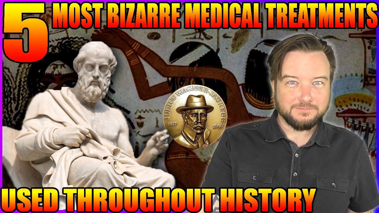 5 Most Bizarre Medical Treatments Used Throughout History YouTube 5-most-bizarre-medical-treatments-used-throughout-history-youtube