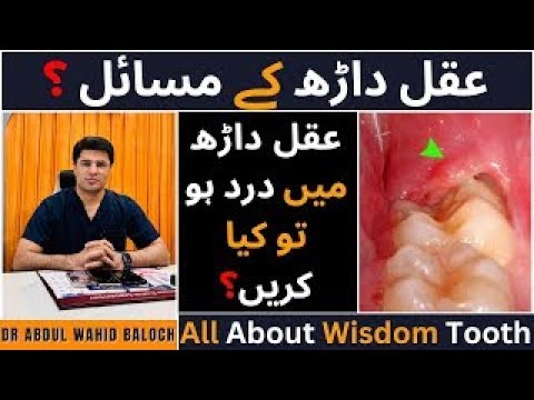 Wisdom Tooth FAQs - Aqal Darh Ke Dard Ka Ilaj | Wisdom Teeth Ke Dard Ka ...