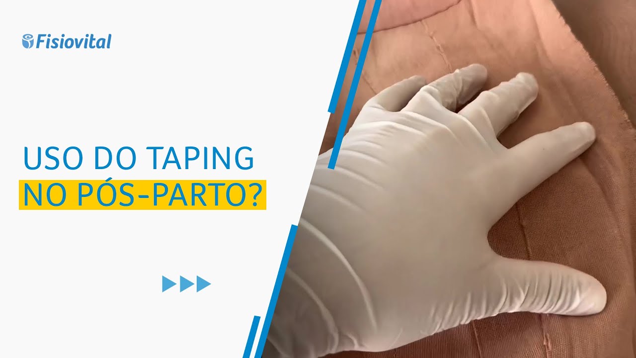 Como funciona o uso do taping no pós-parto? | Fisiovital - YouTube