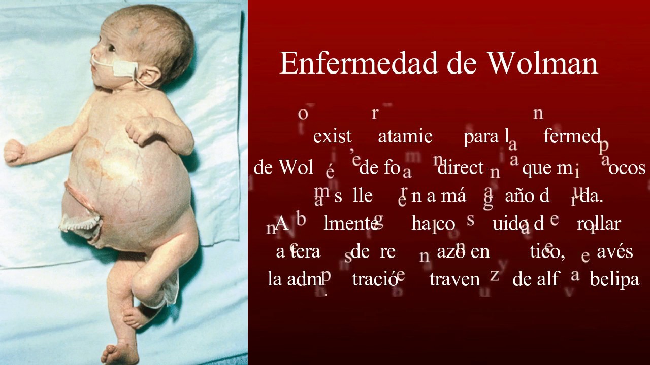 Enfermedad de Wolman - YouTube
