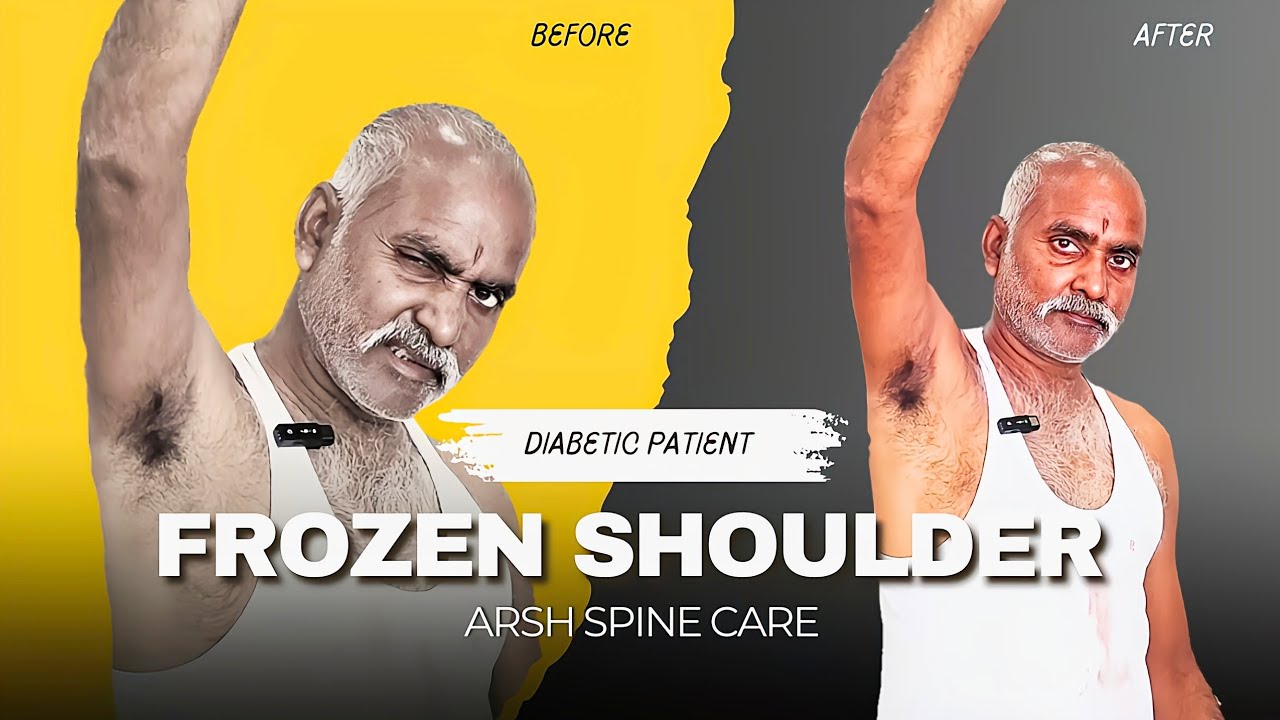 Frozen Shoulder Chiropractic Treatment | Arsh Spine Care | Shoulder ...