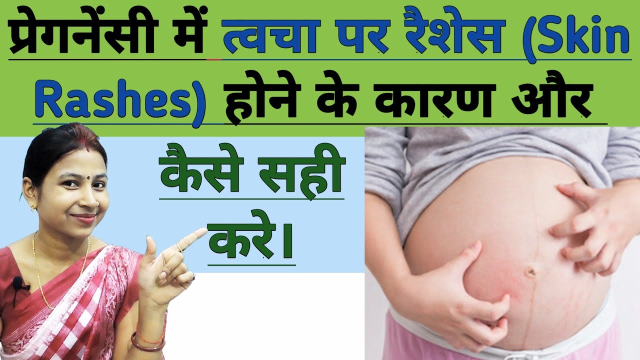 प्रेगनेंसी मे त्वचा पर रैशेज (Skin Rashes) के कारण और कैसे सही करे Skin ...
