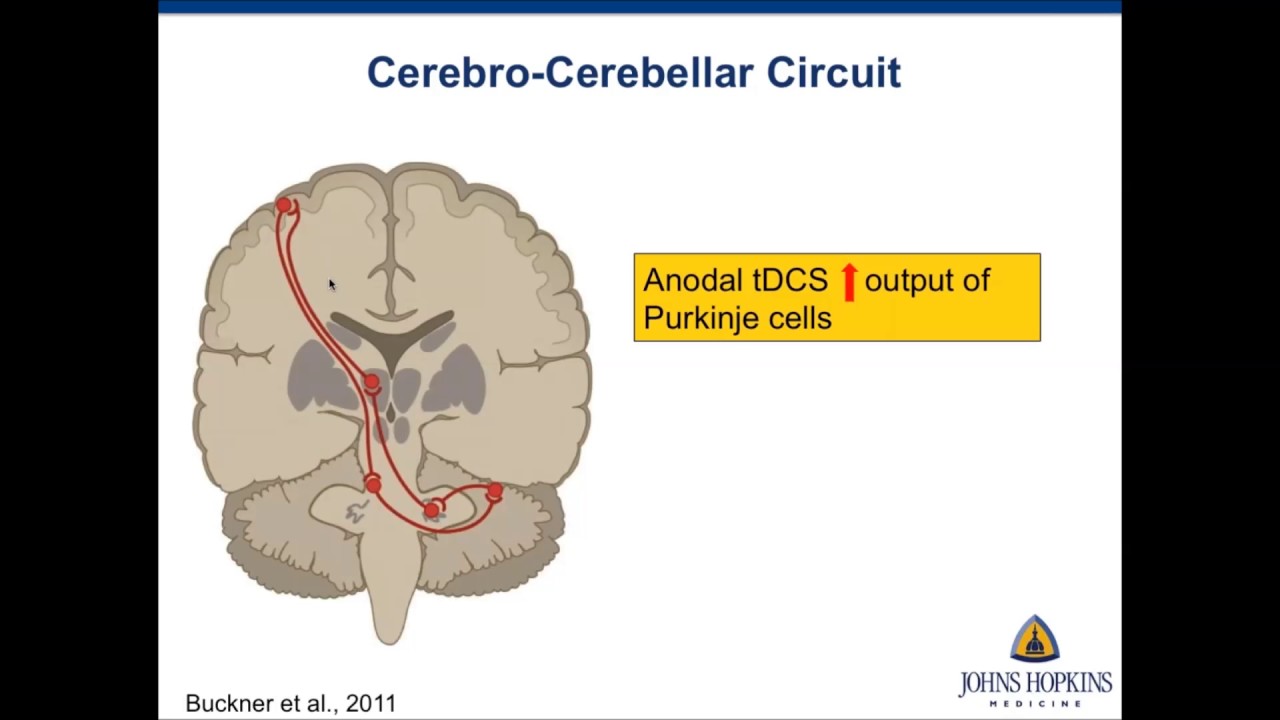 "Cerebellar tDCS: A novel approach to augment aphasia treatment ...