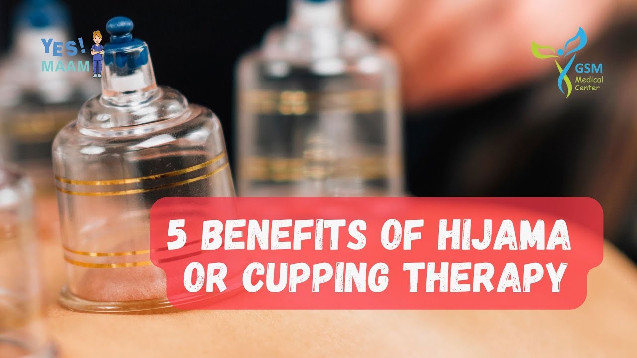 5 BENEFITS OF HIJAMA OR CUPPING THERAPY | #hijama #hijamacupping - YouTube