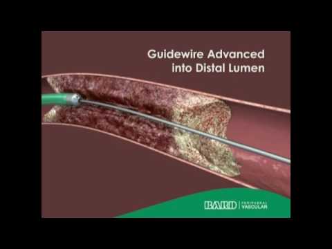 Crosser Animation - YouTube