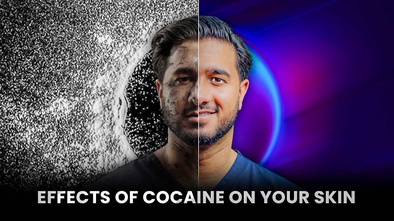 The Shocking Effects Of COCAINE On Your SKIN And The AGEING Process ...